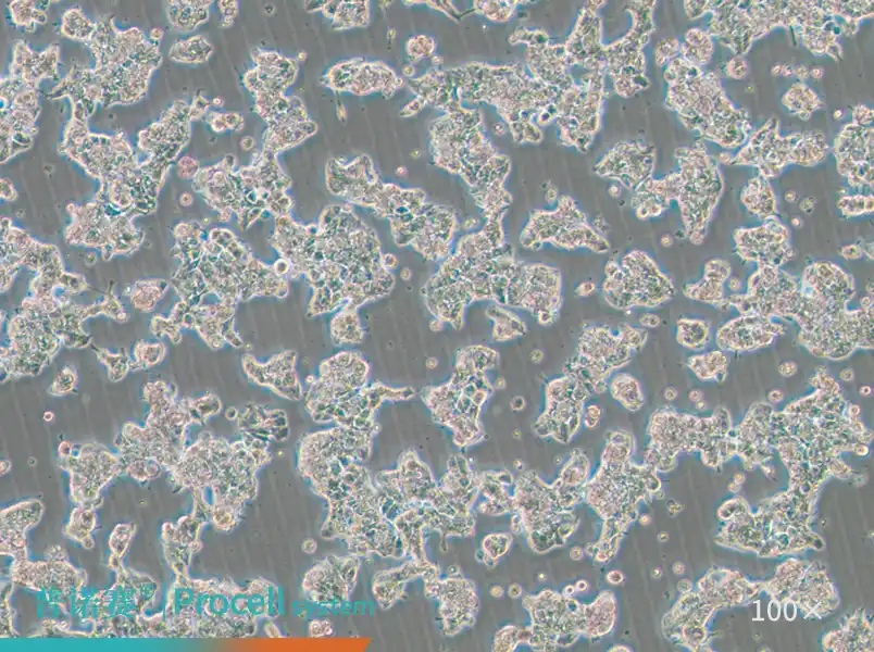 ZR-75-1（人乳腺癌细胞）-细胞系-武汉普诺赛生命科技有限公司