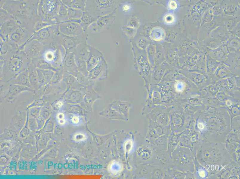SW 780 [SW-780, SW780]（人膀胱移行细胞癌）-细胞系-武汉普诺赛生命科技有限公司