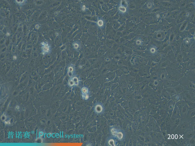 HuCC-T1（人胆管癌细胞）-细胞系-武汉普诺赛生命科技有限公司