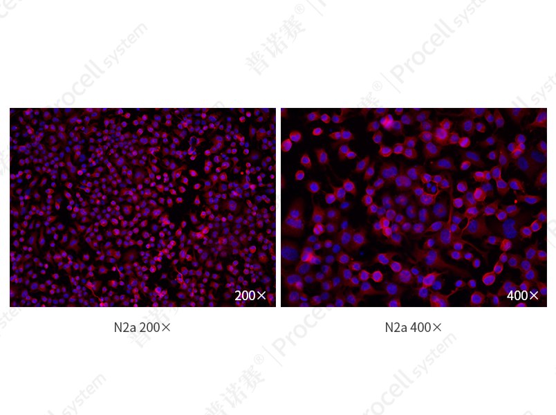 Neuro-2a [N2a; Neuro-2a]（小鼠脑神经瘤细胞）-细胞系-武汉普诺赛生命科技有限公司