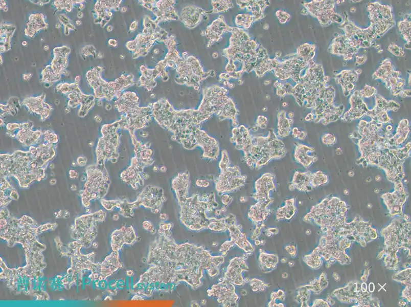 ZR-75-1（人乳腺癌细胞）-细胞系-武汉普诺赛生命科技有限公司