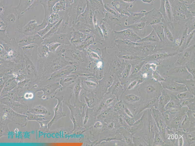 JHH-6（人肝母细胞瘤细胞）-细胞系-武汉普诺赛生命科技有限公司