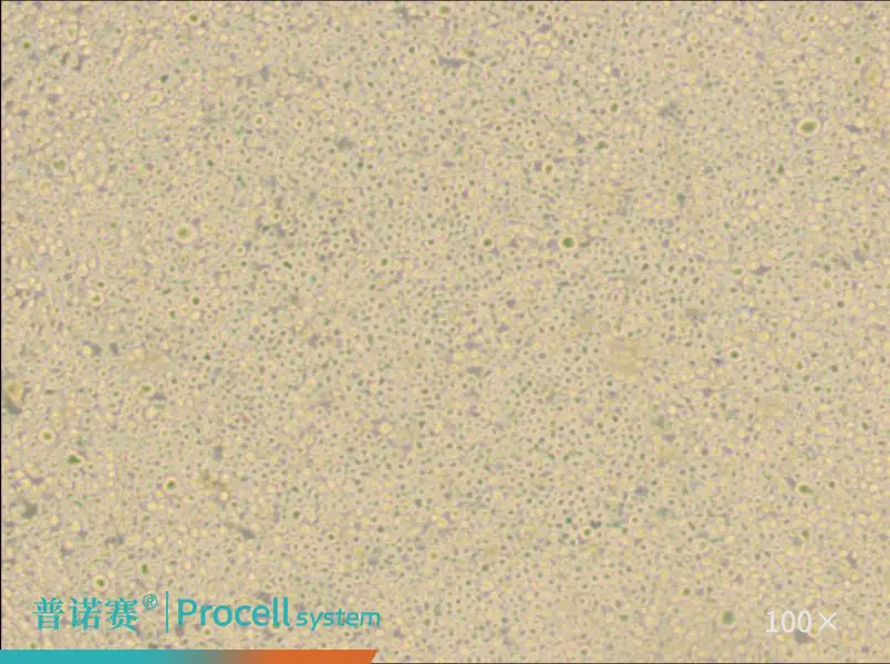 U266 [U266B1]（人多发性骨髓瘤细胞）-细胞系-武汉普诺赛生命科技有限公司