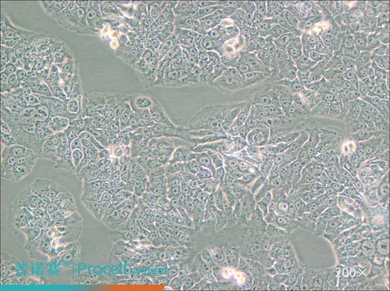 NCI-H1437（人肺癌细胞）-细胞系-武汉普诺赛生命科技有限公司