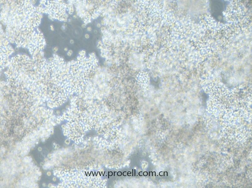 NCI-H2171（人肺癌细胞）-细胞系-武汉普诺赛生命科技有限公司