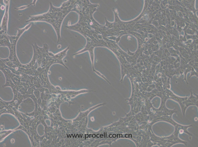 Hep-53.4（小鼠肝癌细胞）-细胞系-武汉普诺赛生命科技有限公司
