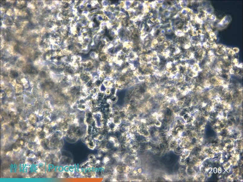 NCI-H526（人小细胞肺癌细胞）-细胞系-武汉普诺赛生命科技有限公司