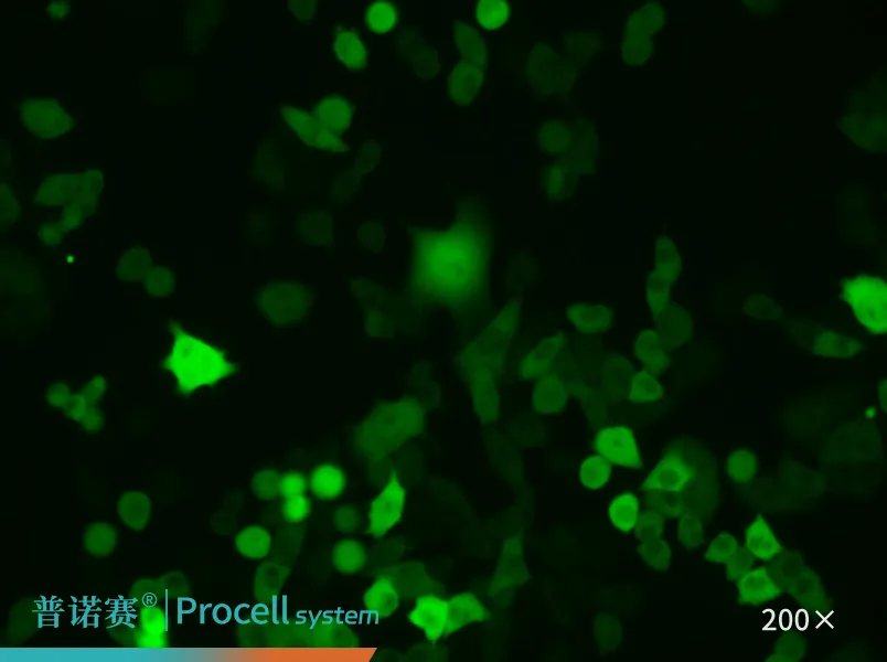 4T1-GFP（小鼠乳腺癌细胞（绿色荧光标记））-细胞系-武汉普诺赛生命科技有限公司