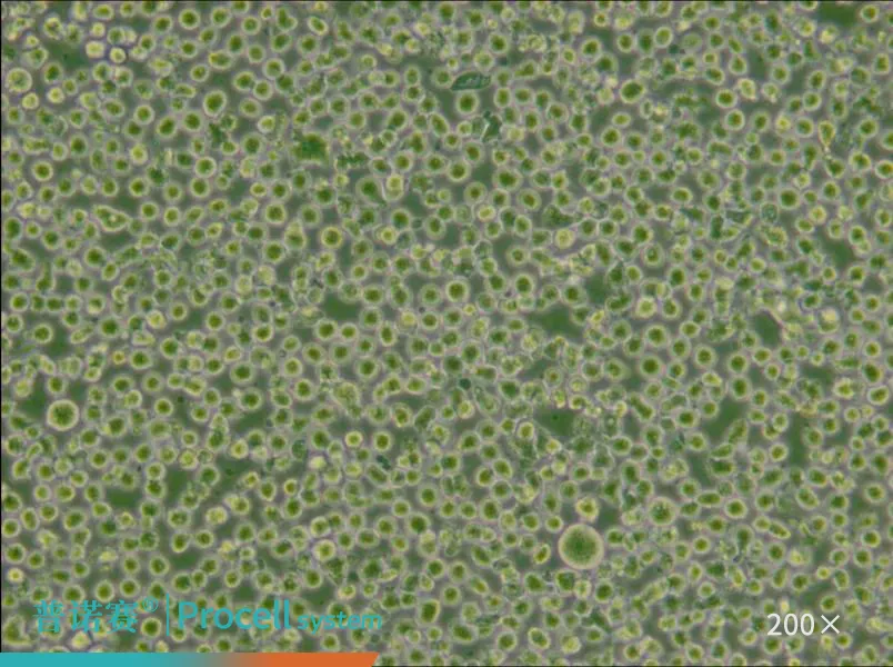 U266 [U266B1]（人多发性骨髓瘤细胞）-细胞系-武汉普诺赛生命科技有限公司