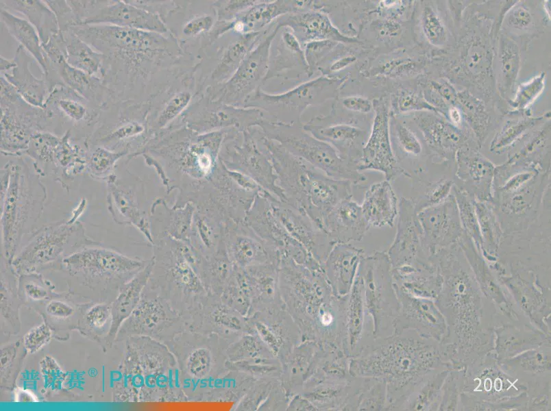 JHH-6（人肝母细胞瘤细胞）-细胞系-武汉普诺赛生命科技有限公司