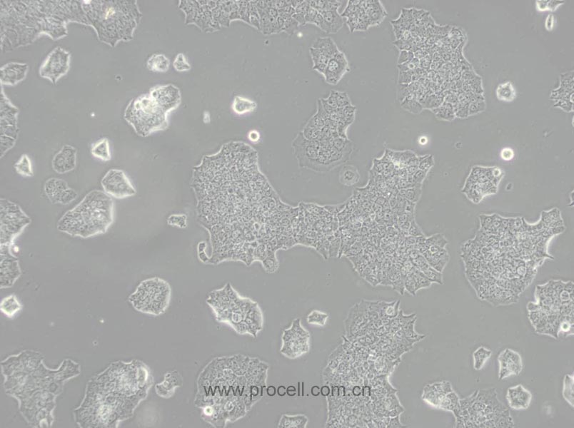 BT-474 [BT474]（人乳腺导管癌细胞）-细胞系-武汉普诺赛生命科技有限公司