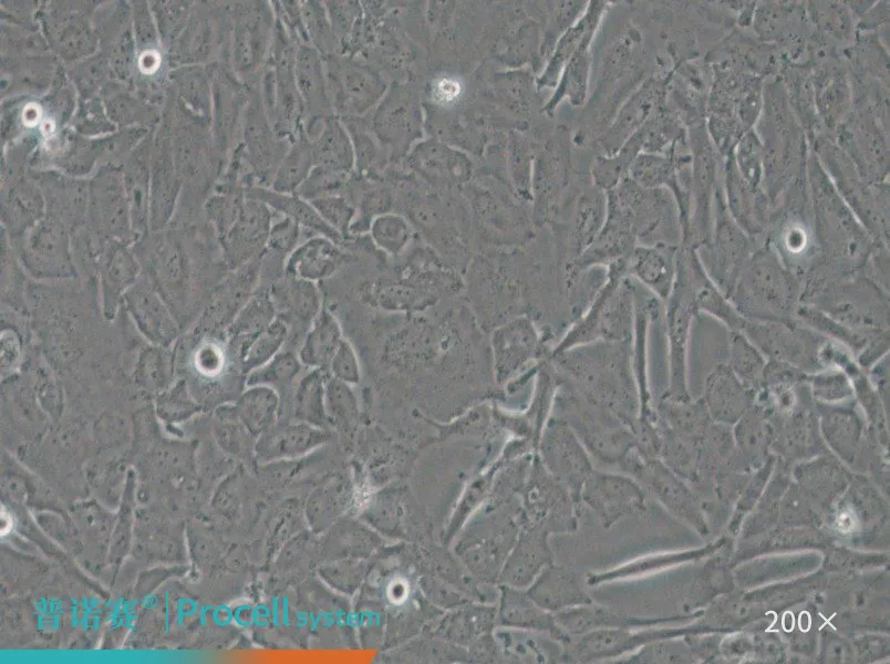 OCUT-2C（人甲状腺癌细胞（未分化））-细胞系-武汉普诺赛生命科技有限公司