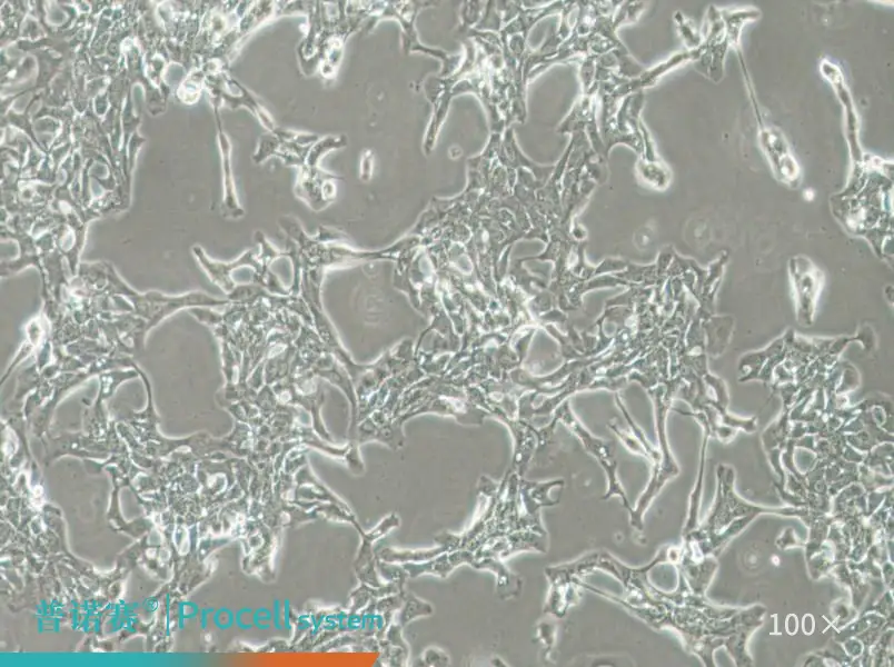HCC70（人乳腺导管癌细胞）-细胞系-武汉普诺赛生命科技有限公司