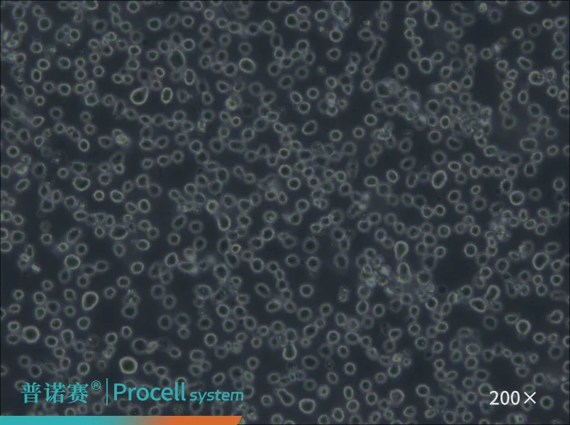 Karpas-299（人间变性大细胞淋巴瘤细胞）-细胞系-武汉普诺赛生命科技有限公司