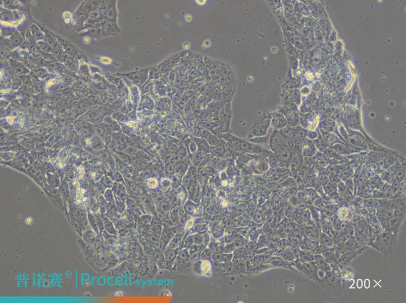 LCLC-97TM1（人大细胞肺癌细胞）-细胞系-武汉普诺赛生命科技有限公司