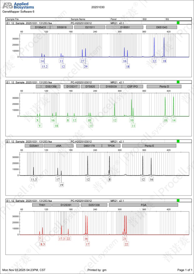 Karpas-299（人间变性大细胞淋巴瘤细胞）-细胞系-武汉普诺赛生命科技有限公司
