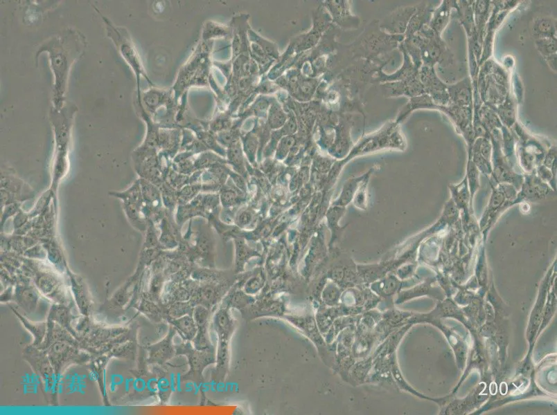 HCC70（人乳腺导管癌细胞）-细胞系-武汉普诺赛生命科技有限公司