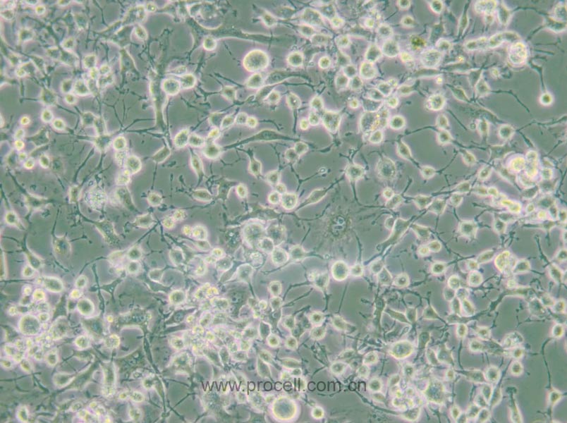 MDA-MB-436（人乳腺癌细胞）-细胞系-武汉普诺赛生命科技有限公司
