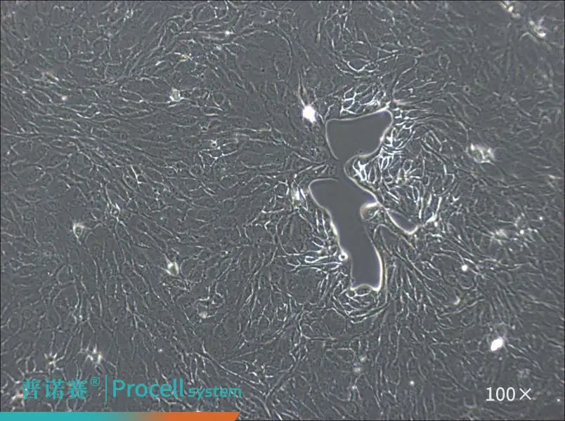 NCI-H2444（人非小细胞肺癌细胞）-细胞系-武汉普诺赛生命科技有限公司