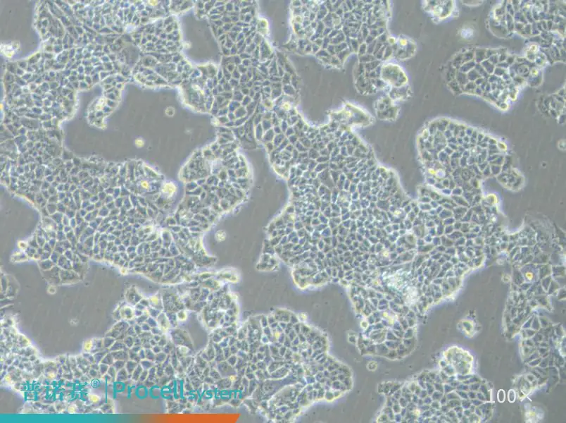 MCF-7-FLUC（人乳腺癌细胞（FLUC标记））-细胞系-武汉普诺赛生命科技有限公司