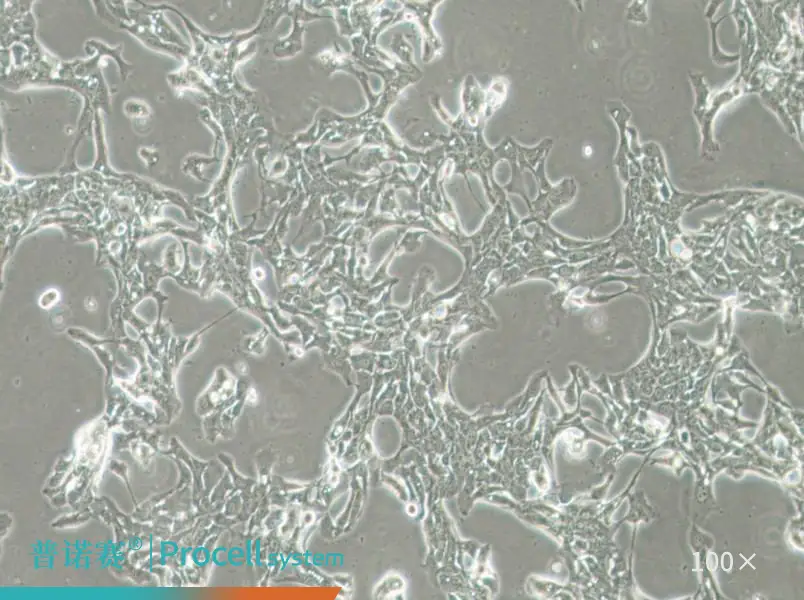 HCC70（人乳腺导管癌细胞）-细胞系-武汉普诺赛生命科技有限公司