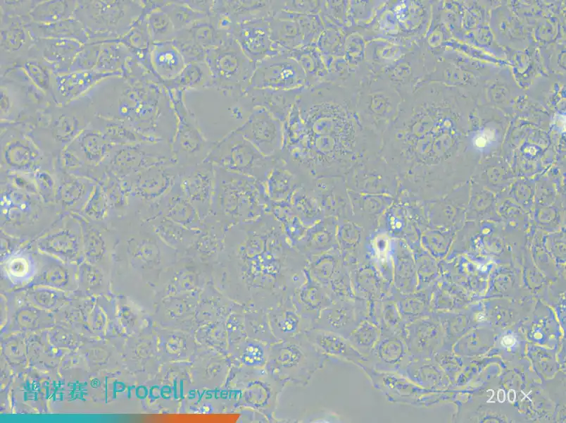 SW 780 [SW-780, SW780]（人膀胱移行细胞癌）-细胞系-武汉普诺赛生命科技有限公司