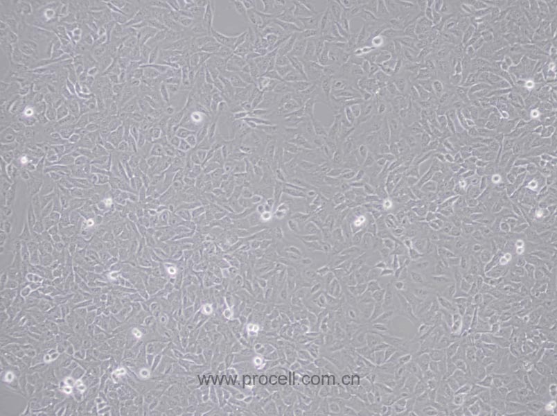 U-2 OS [U2OS]（人骨肉瘤细胞）-细胞系-武汉普诺赛生命科技有限公司