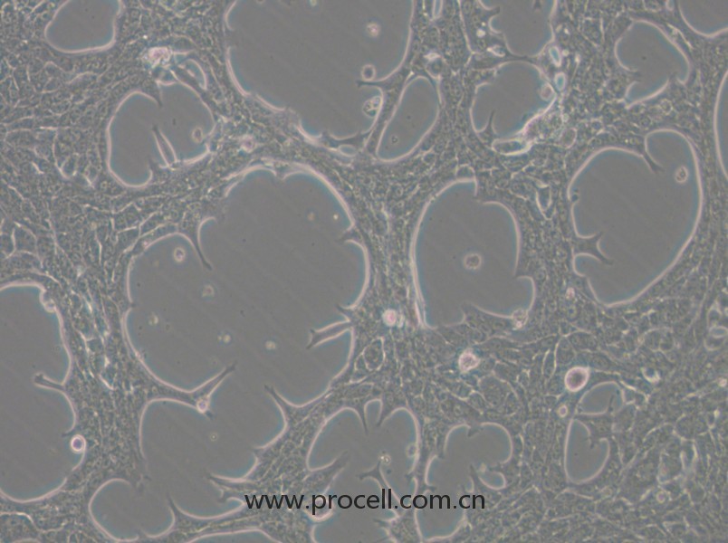Hep-53.4（小鼠肝癌细胞）-细胞系-武汉普诺赛生命科技有限公司