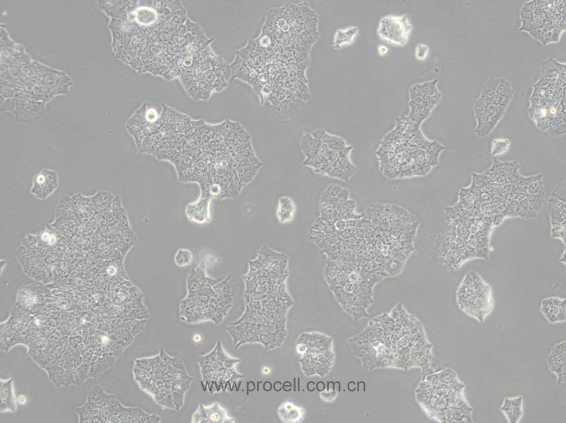 BT-474 [BT474]（人乳腺导管癌细胞）-细胞系-武汉普诺赛生命科技有限公司