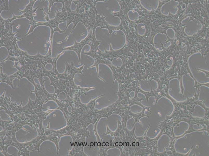 Hep-53.4（小鼠肝癌细胞）-细胞系-武汉普诺赛生命科技有限公司