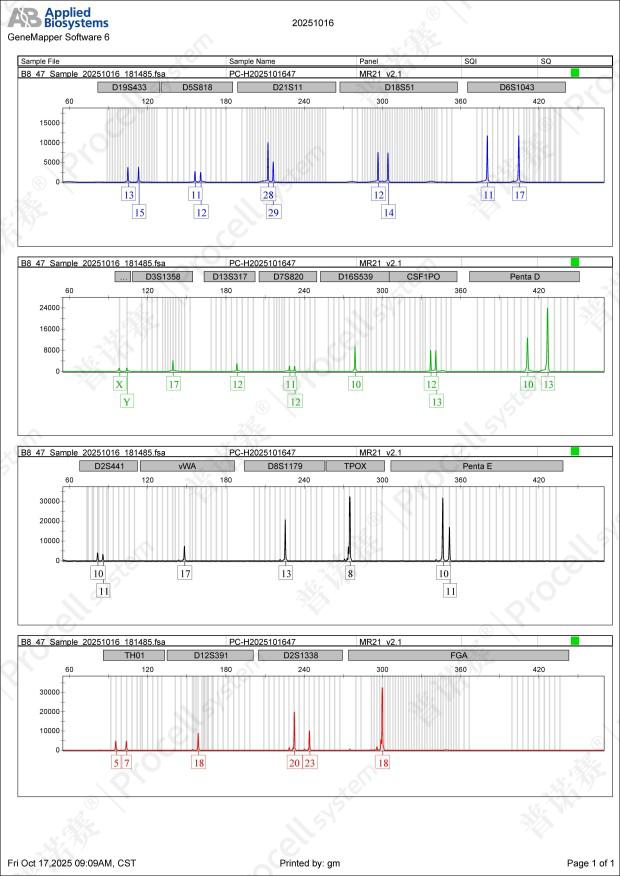 U266 [U266B1]（人多发性骨髓瘤细胞）-细胞系-武汉普诺赛生命科技有限公司