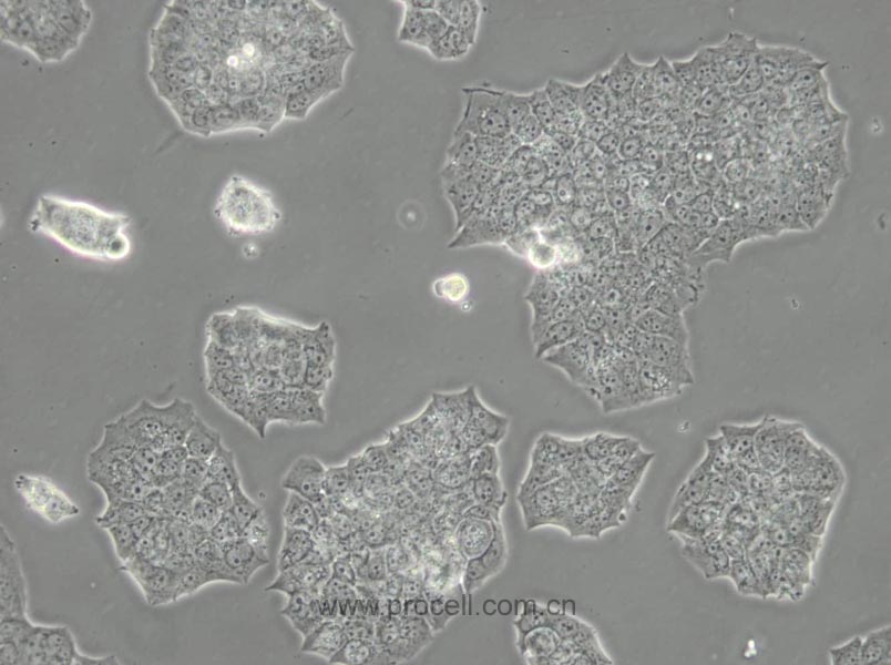 BT-474 [BT474]（人乳腺导管癌细胞）-细胞系-武汉普诺赛生命科技有限公司