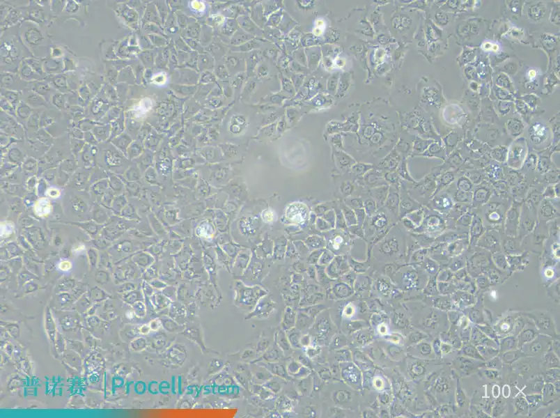 SW 780 [SW-780, SW780]（人膀胱移行细胞癌）-细胞系-武汉普诺赛生命科技有限公司