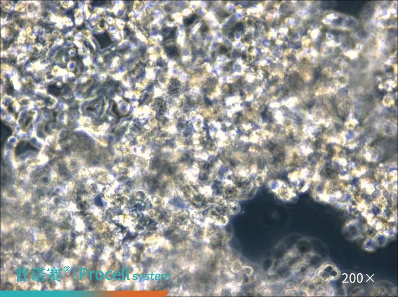 NCI-H526（人小细胞肺癌细胞）-细胞系-武汉普诺赛生命科技有限公司