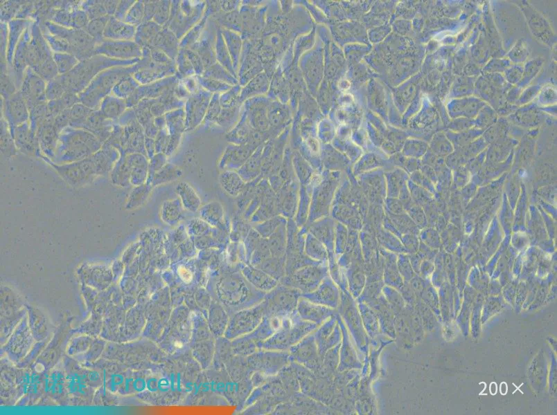 NCI-H358（人非小细胞肺癌细胞）-细胞系-武汉普诺赛生命科技有限公司