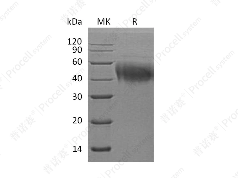 IL-4Rα/CD124 (C-6His), Human, Recombinant-细胞因子-武汉普诺赛生命科技有限公司